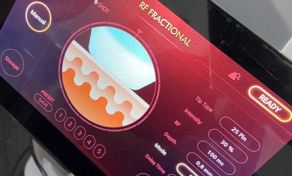 Rejuvenate Your Look With Secret RF Micro-Needling